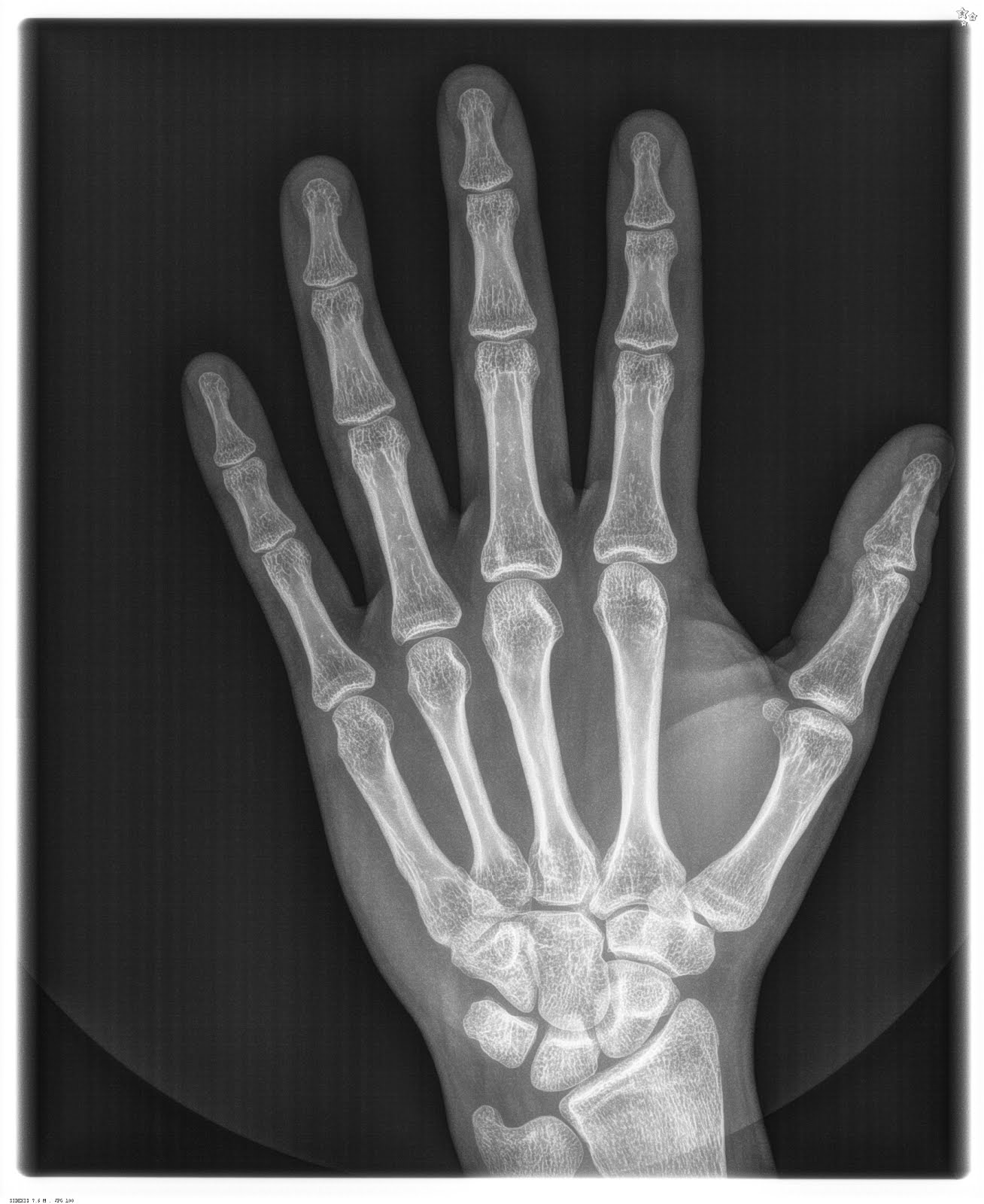 RADIOGRAFÍA CARPAL ~ MEDICAL DENTIX S.A.C.