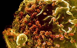 MEDICINA: INFECCIÓN GONOCÓCICA