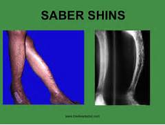 Hello USA: saber shins