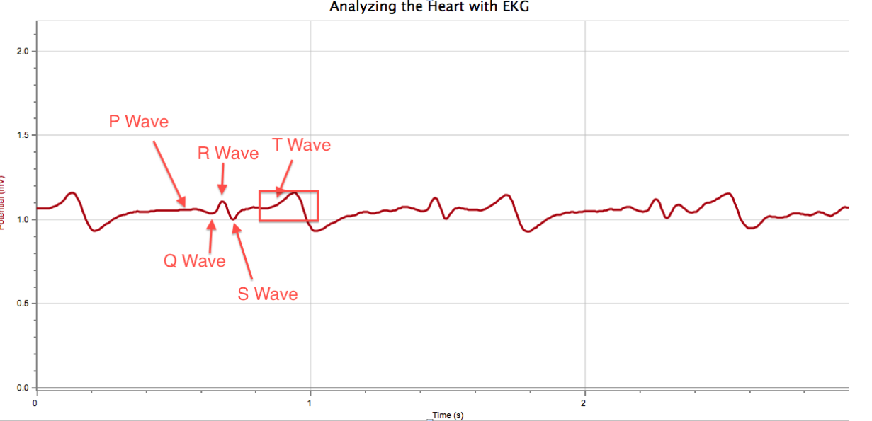 Human Anatomy & Physiology: EKG Lab