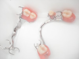 Laprotege: PPR,Prótese Parcial Removível