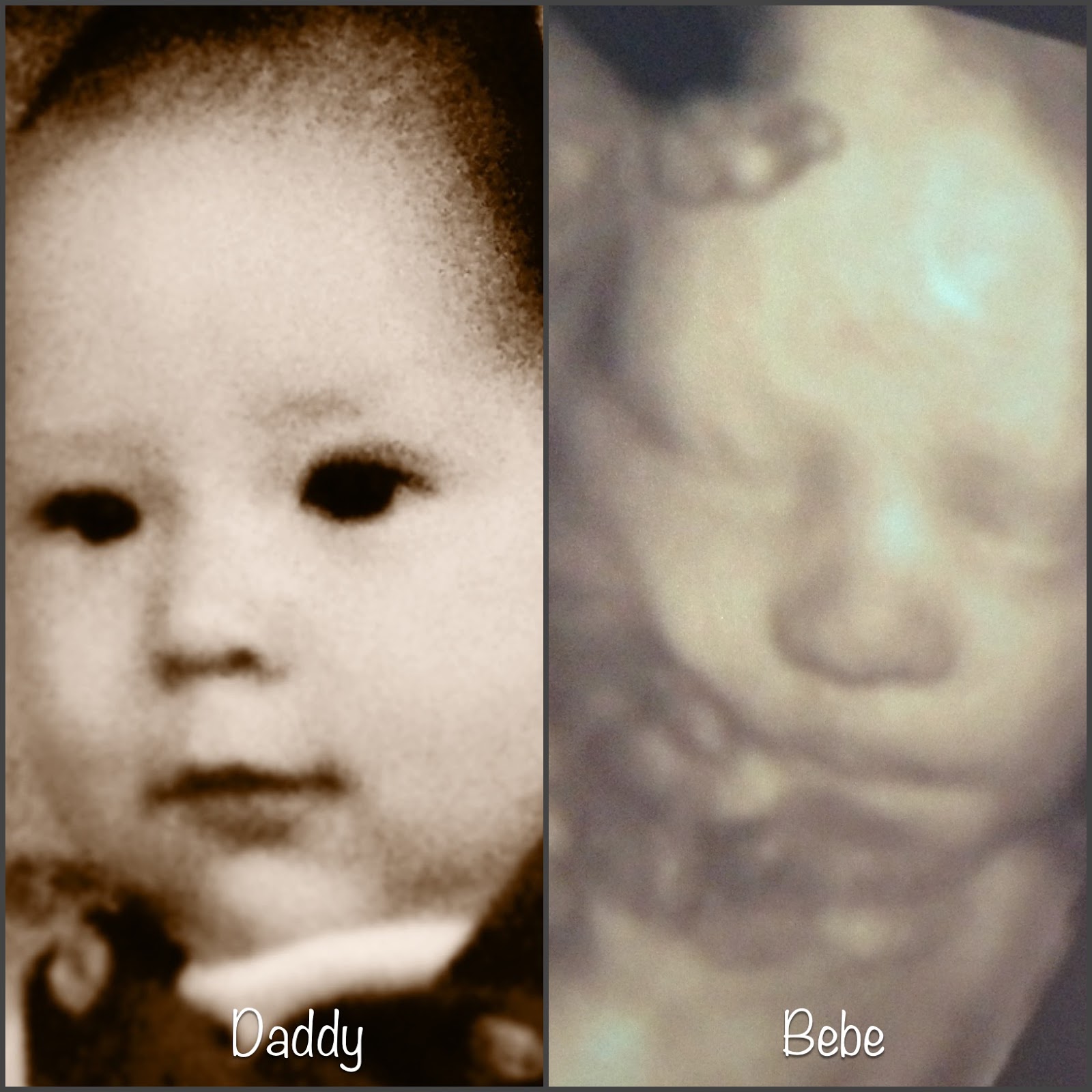 Hello, Bebe Watkins!: 4D Ultrasound | 31 Weeks