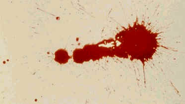CSI!: Blood Splatter