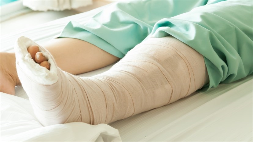 Complex Fracture Treatment | Complex Bone Fracture Surgery