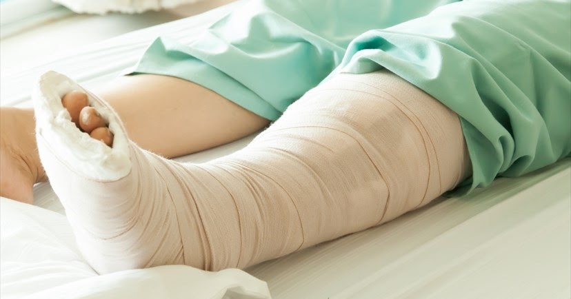 Complex Fracture Treatment | Complex Bone Fracture Surgery