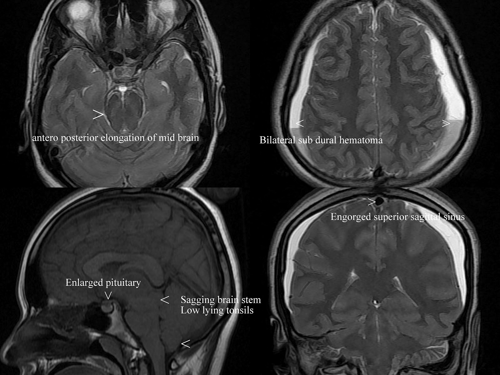Dr Balaji Anvekar FRCR: 01/06/12 - 01/07/12