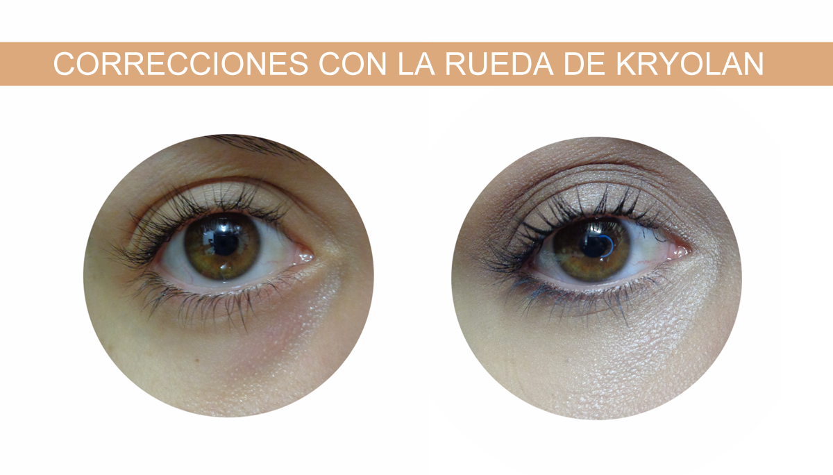 CORRECCIONES CON KRYOLAN