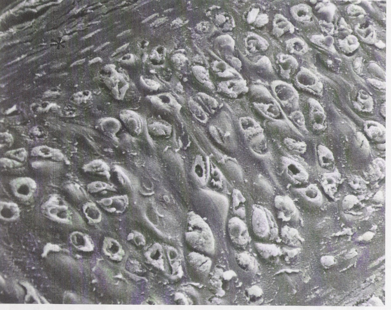 Patologias Humanas : Tecido Cartilaginoso