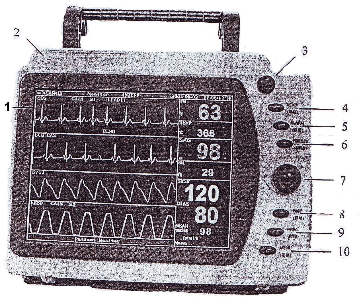 mulai baru lagi: Pasien monitor Analogic ASC-553