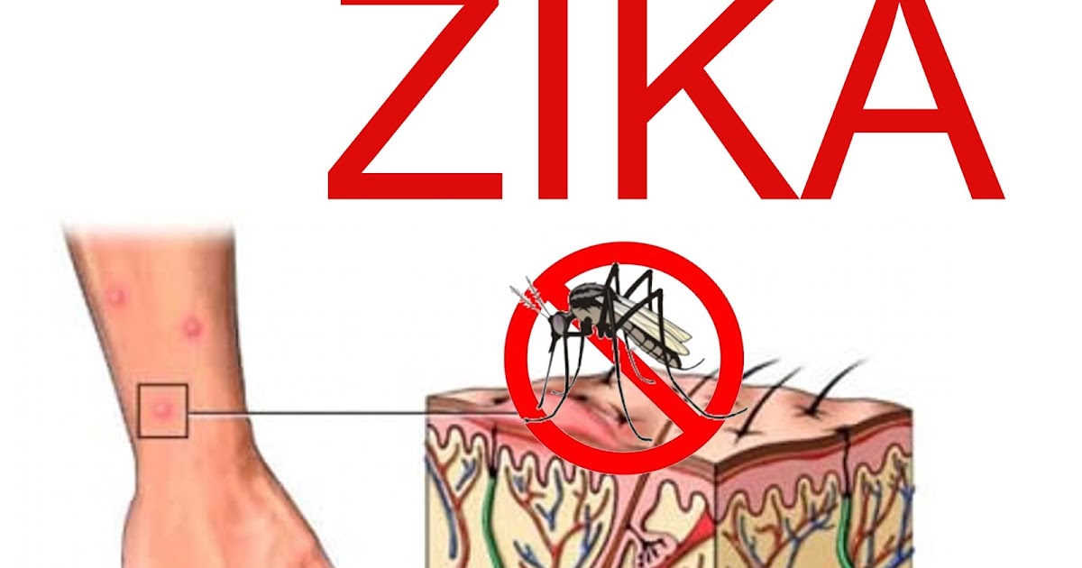 Estética y Nutrición Garofalo.: El virus ZIKA. Estética y Nutrición Garofalo.: El virus ZIKA.