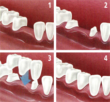 Dental sky - All about healthy smile: Basic Informations About Dental ...