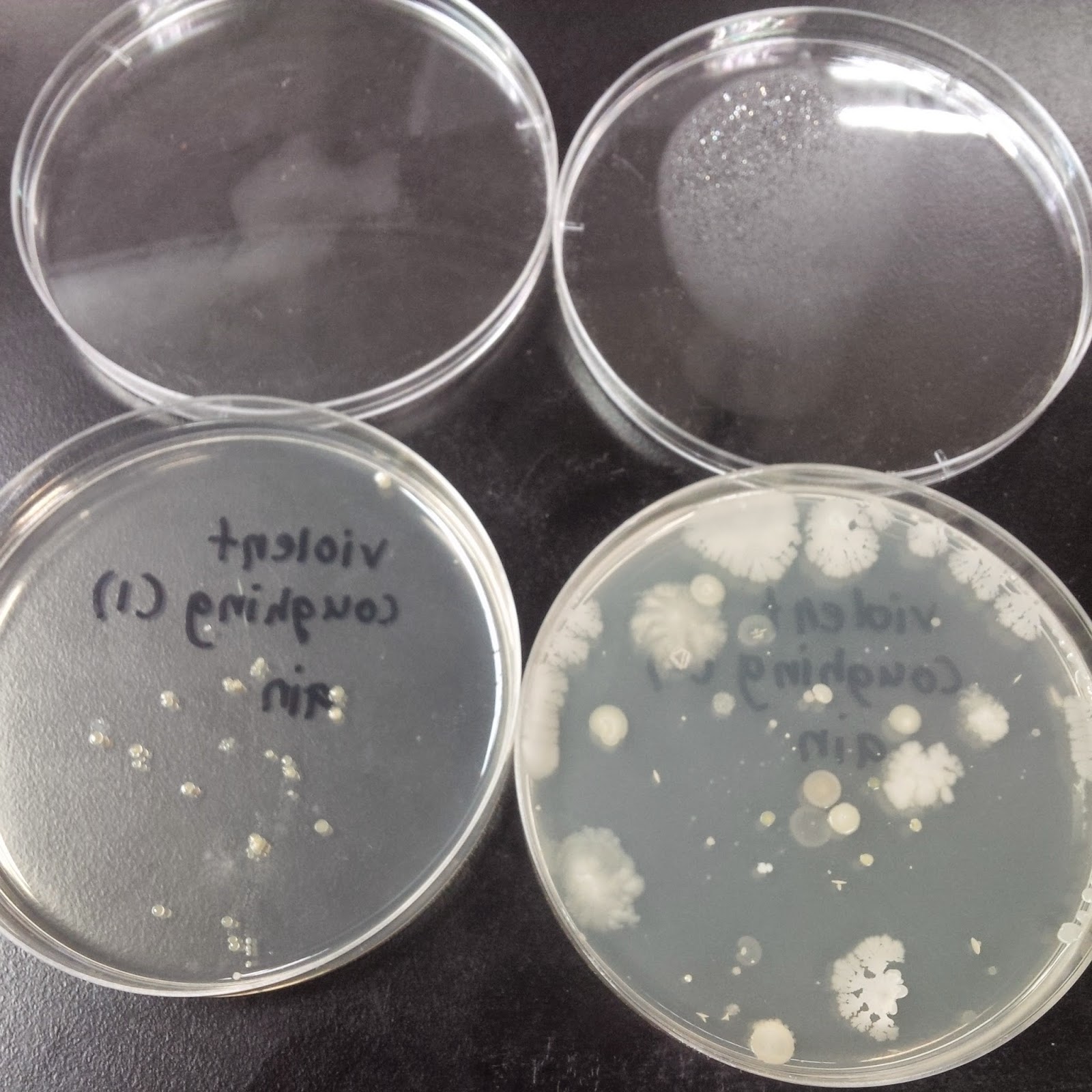 Lab IBG102: Lab 4 : Sources of Contamination and Infection