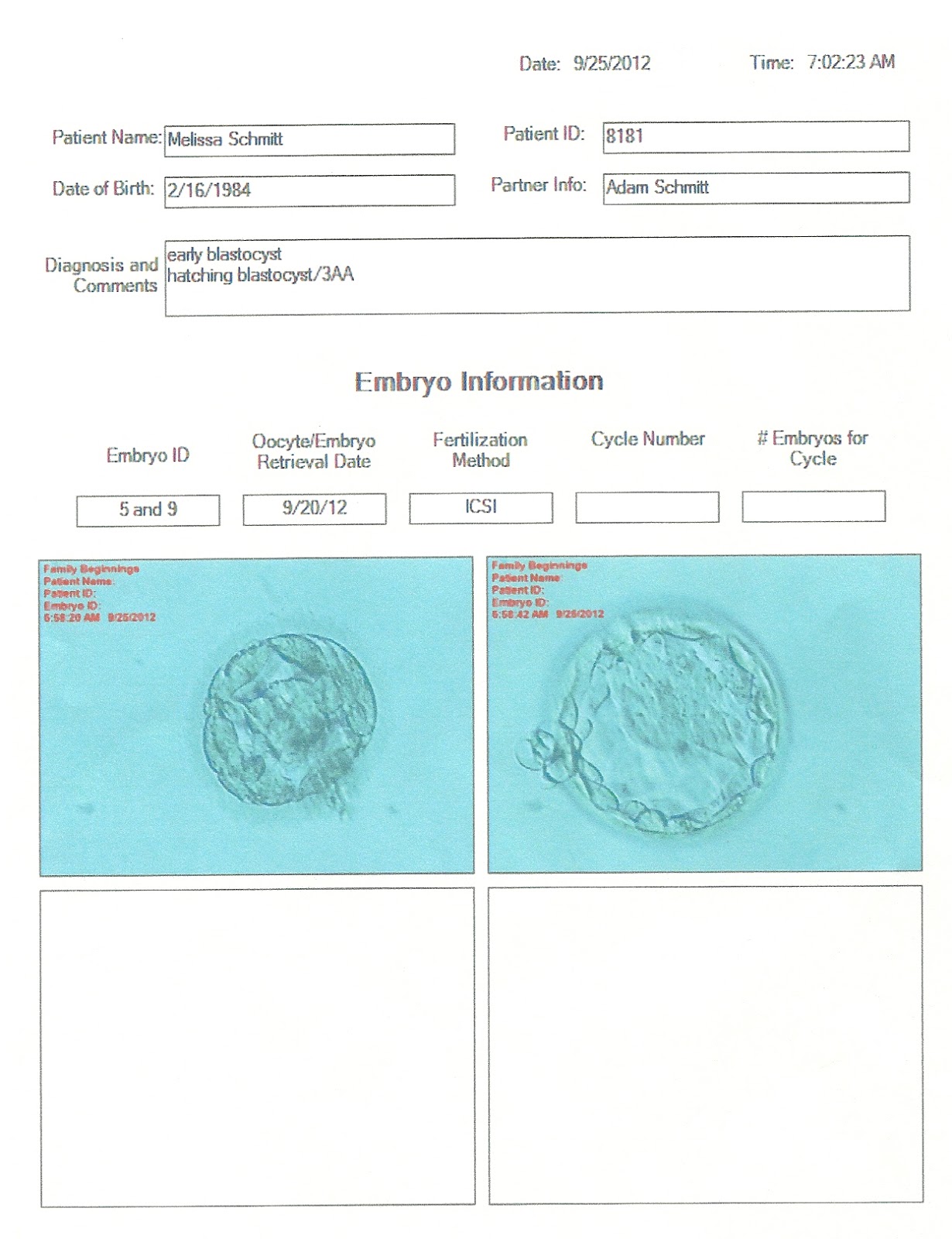 Going from 2 to 3: Embryo Transfer