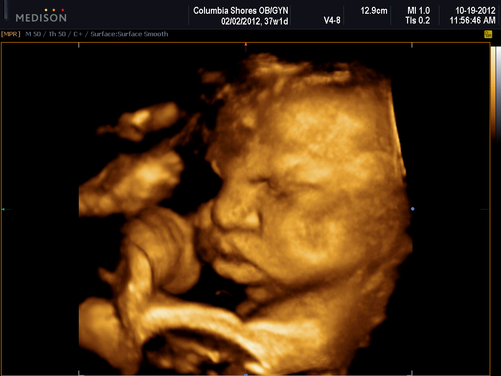 Baby Wynne: 37 Weeks, 3 days