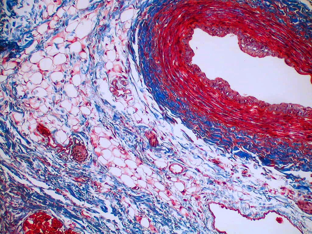 SOS BIOLOGIA CELULAR Y TISULAR: CORAZON. HISTOLOGIA