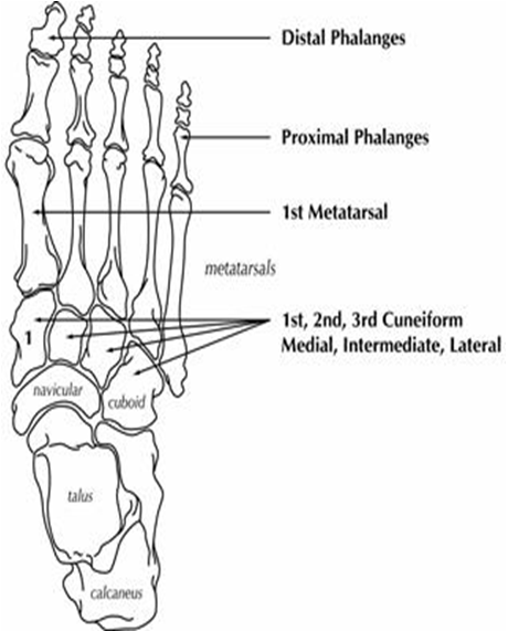 Human skeleton anatomy: Congenital Talipes Equinovarus Clubfoot