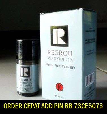 Punya Masalah Rambut Rontok dan Botak Ini Solusinya - Ira Mei