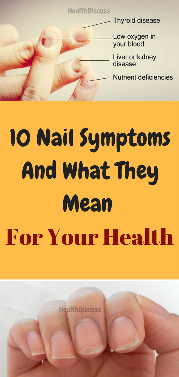 Health Discuss: 10 Nail Symptoms and What They Mean for Your Health