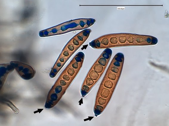 Fun With Microbiology (What's Buggin' You?): Exserohilum rostratum