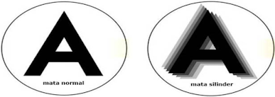 Obat Mata Silinder Tradisional | Obat Mata Silinder Di Apotik