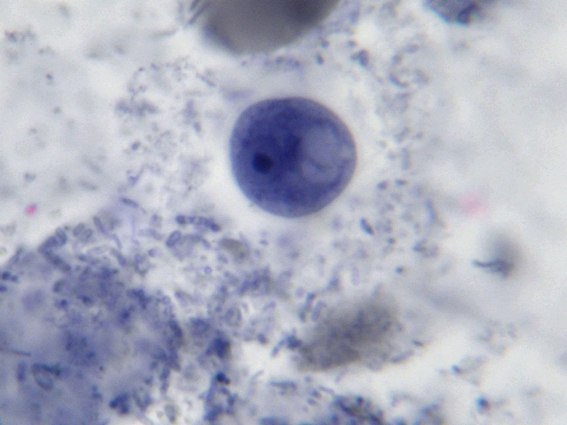 Fun With Microbiology (What's Buggin' You?): Iodamoeba bütschlii