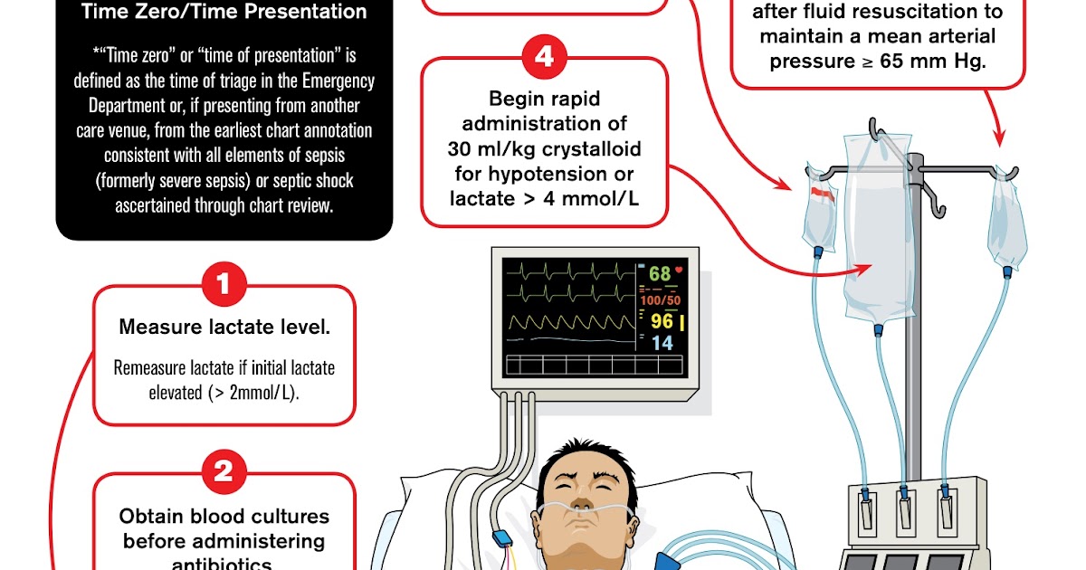 急診夜未眠: 1-Hour Bundle for Sepsis: SSC 2018 Update