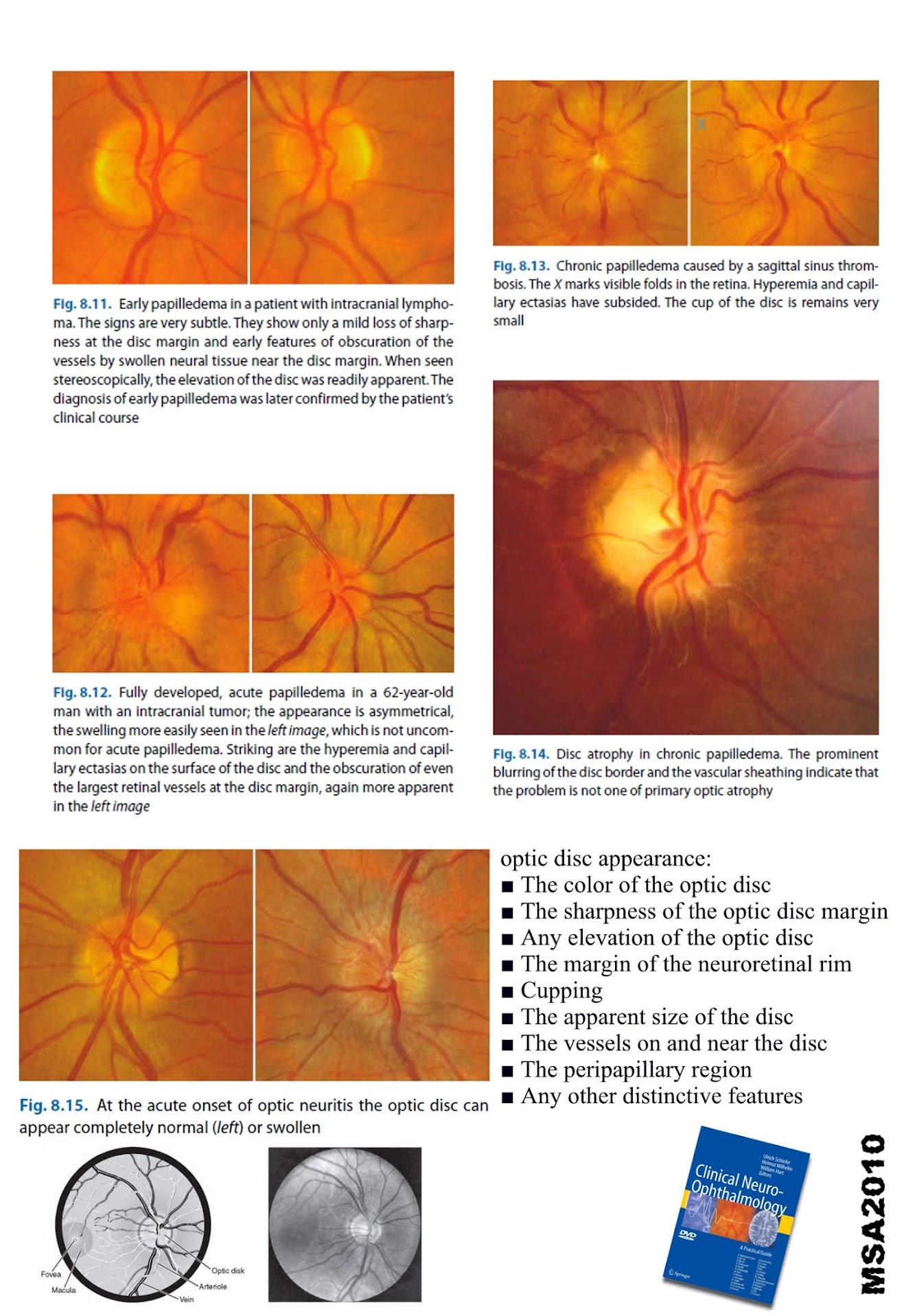 Vaskularisasi jalur visual