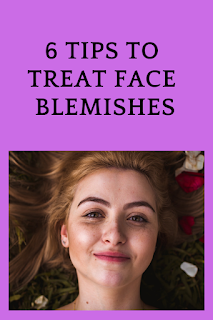 6 Tips To Treat Face Blemishes