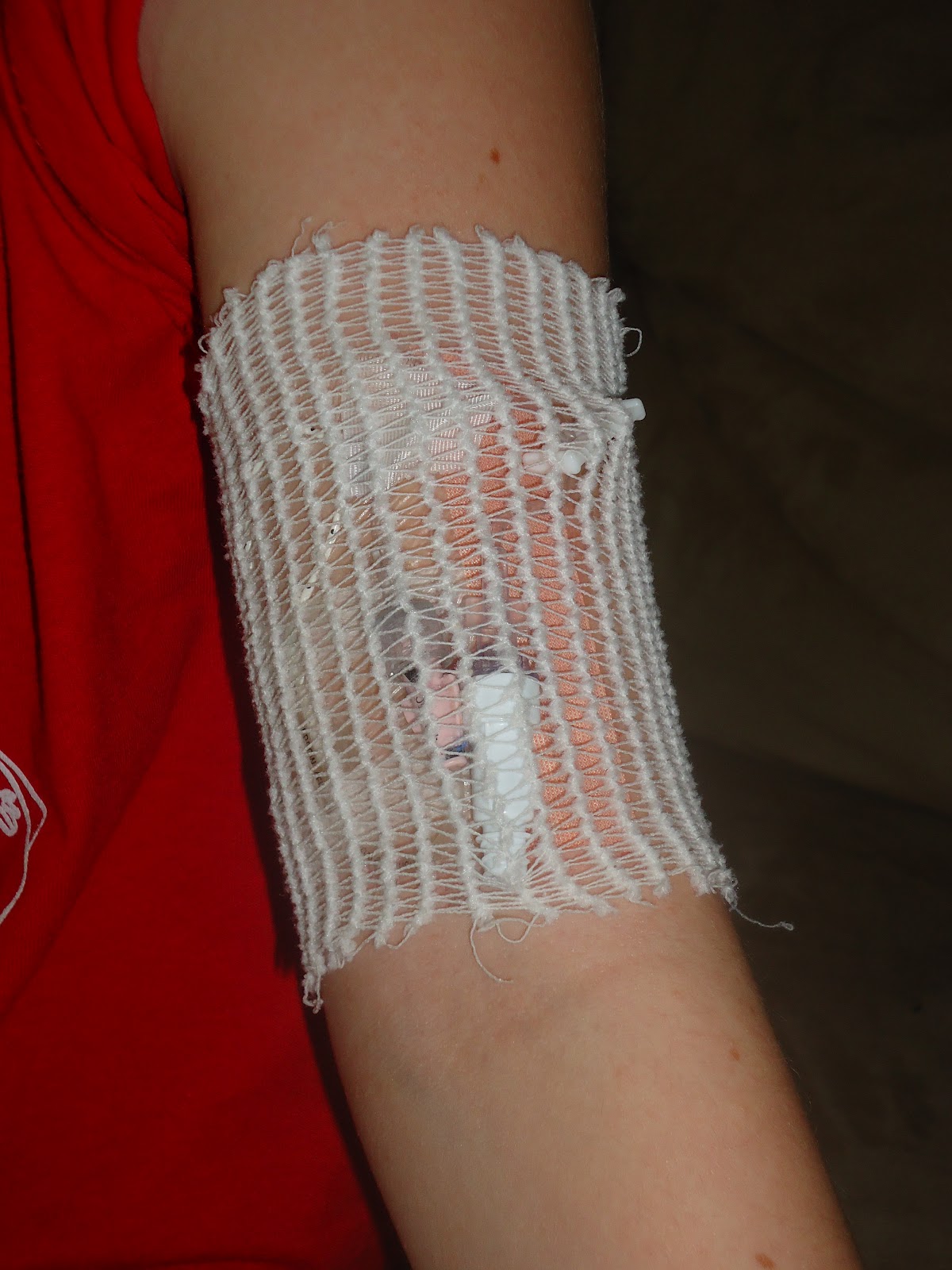 A Day in the Lyme Life: The PICC Line