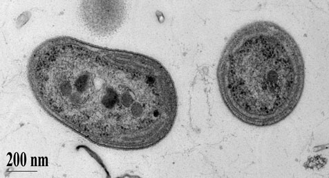 Pengelompokkan Bakteri Berdasarkan Kebutuhan Oksigen dan Cara Geraknya ...