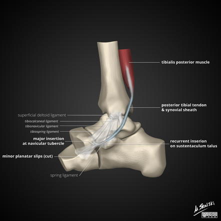 MRI Musculo-Skeletal Section: Spring complex ligament.
