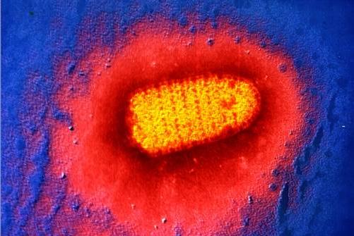 Patologías vampíricas #Halloween y #Ciencia