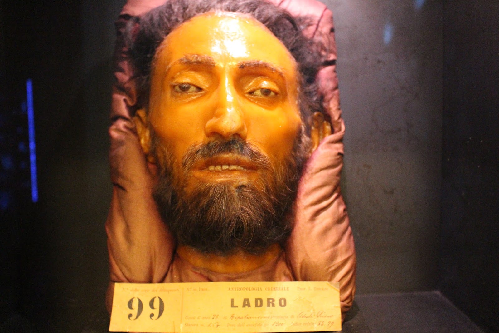 Reportage On Way: Museo di Antropologia Criminale Cesare Lombroso - Torino