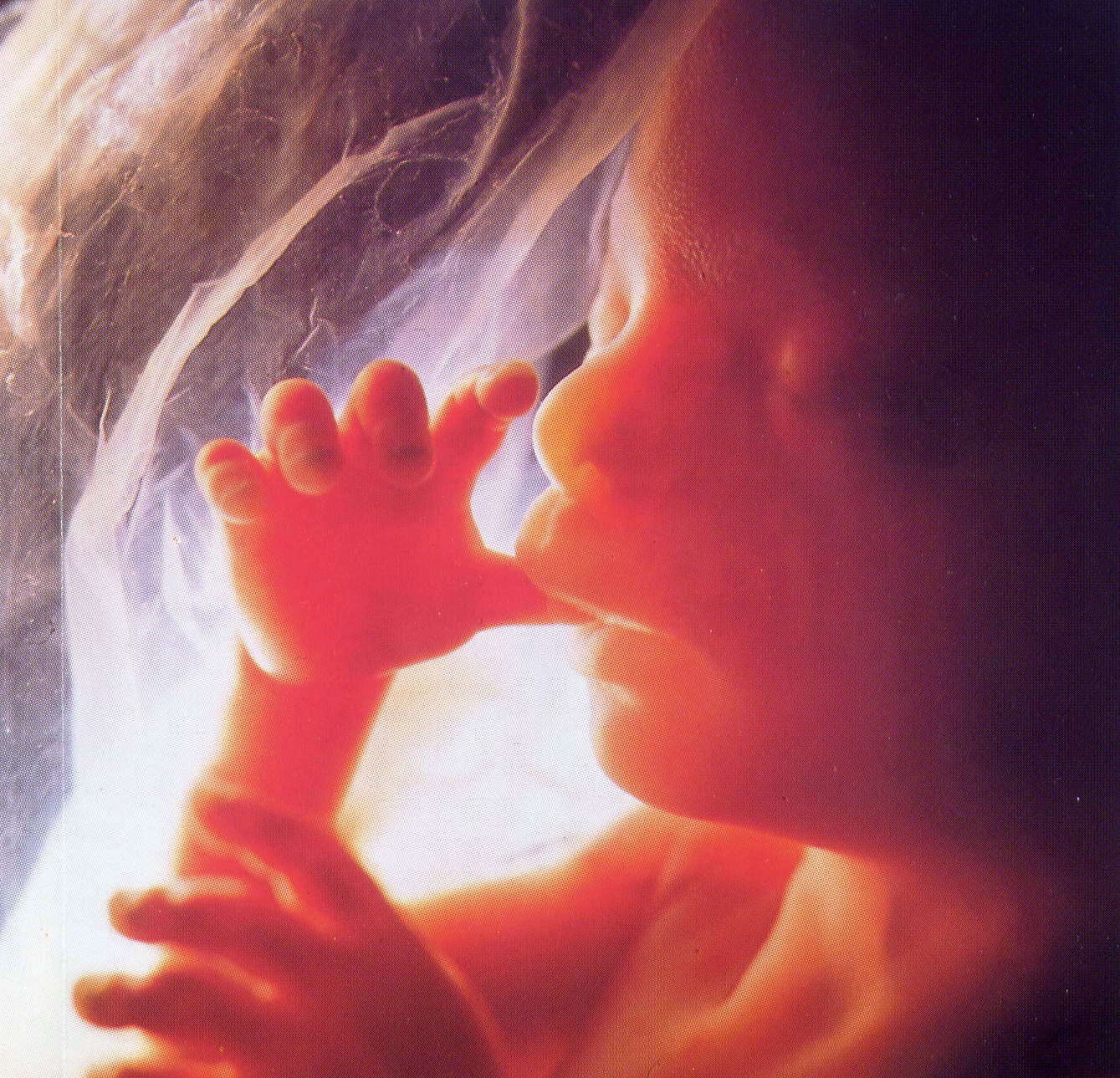 The Body of Christ: Abortion and God's Gift