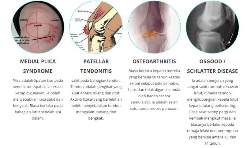 Ubat Sakit Lutut Sendi: PENAWAR SAKIT LUTUT DAN SENDI