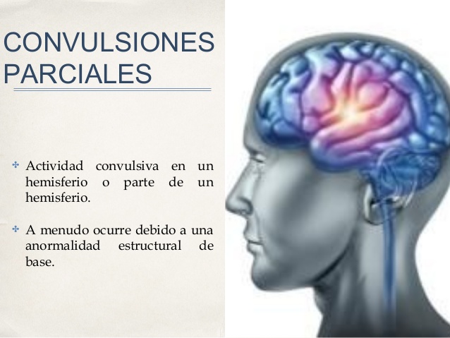 CONVULSIONES PARCIALES