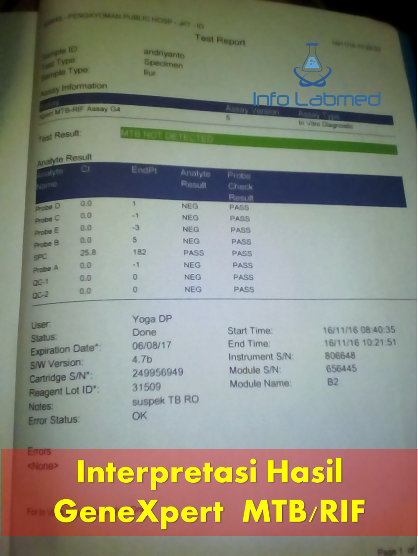 GeneXpert MTB/RIF (Pengoperasian Alat, Prosedur, dan Interpretasi Hasil ...