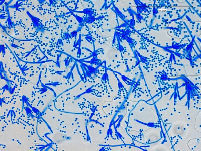 Fun With Microbiology (What's Buggin' You?): Penicillium citrinum