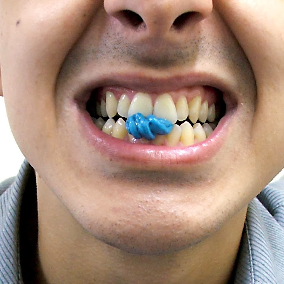 Clínica del Cerebro: Mascar chicle; causa poco reconocida de: dolor de ...