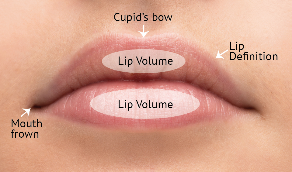 Selston Cosmetic Clinic: Achieve Fuller, Pouty Lips with Lip ...