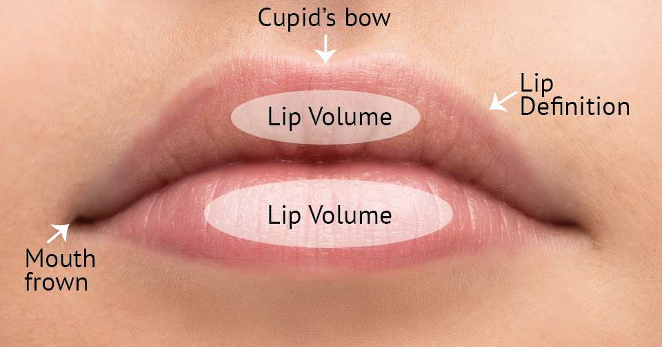 Selston Cosmetic Clinic: Achieve Fuller, Pouty Lips with Lip ...