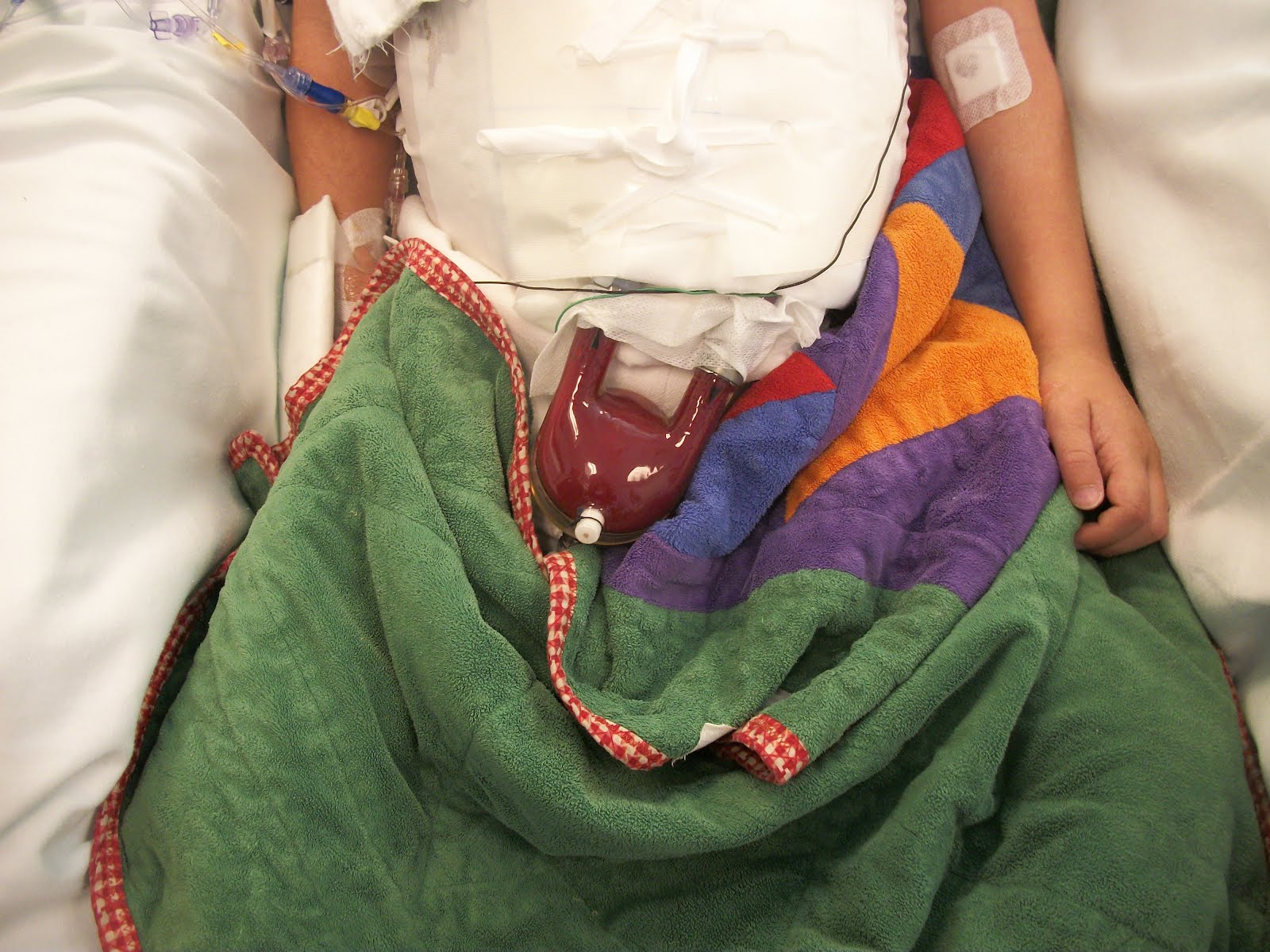 Felt So Fine: Hospital Journal: ECMO & L-VAD & Berlin...OH MY!