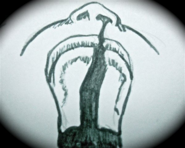 Unidad Funcional del Fisurado: Labio Leporino y/o Fisura Palatina