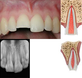 Dentistry lectures for MFDS/MJDF/NBDE/ORE: A Note On Definition ...