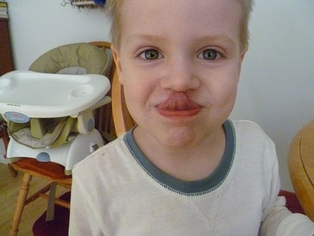 THIS I KNOW | a mommy blog about our son with special needs: Is It Genetic?