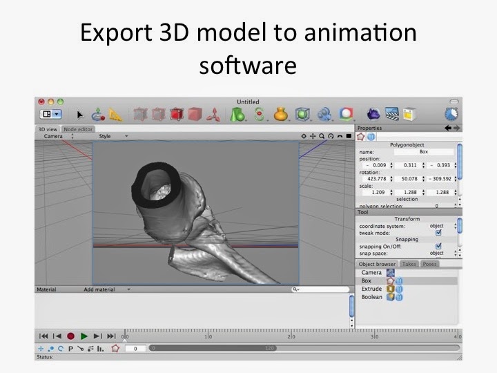 Shoulder and Elbow Surgery: The use of 3-dimensional computer ...