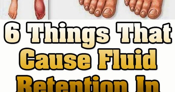 6 Things That Cause Fluid Retention In Your Body And How To Avoid Them ...