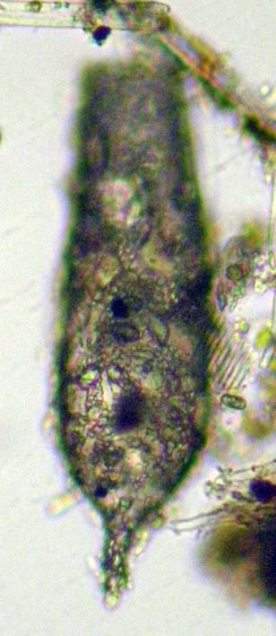 Beyond the Human Eye: Life in 10 Drops of Water: Assorted Protists and ...