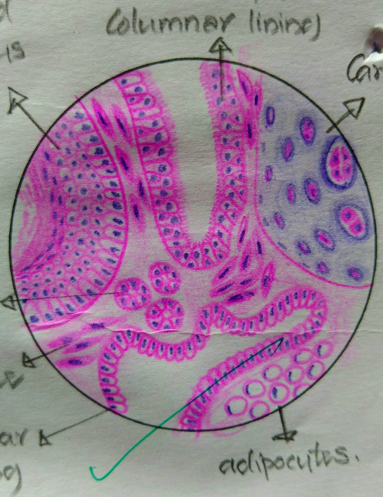 Histopathology Drawings: August 2017