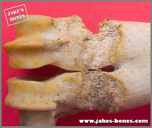 Strange bones #14: Two weird bone pathologies : Jake's Bones